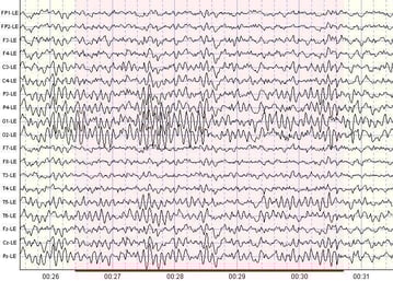 The Different Types of Brainwaves | Brainwaves 101 with Dr. Jeff Tarrant - Healium